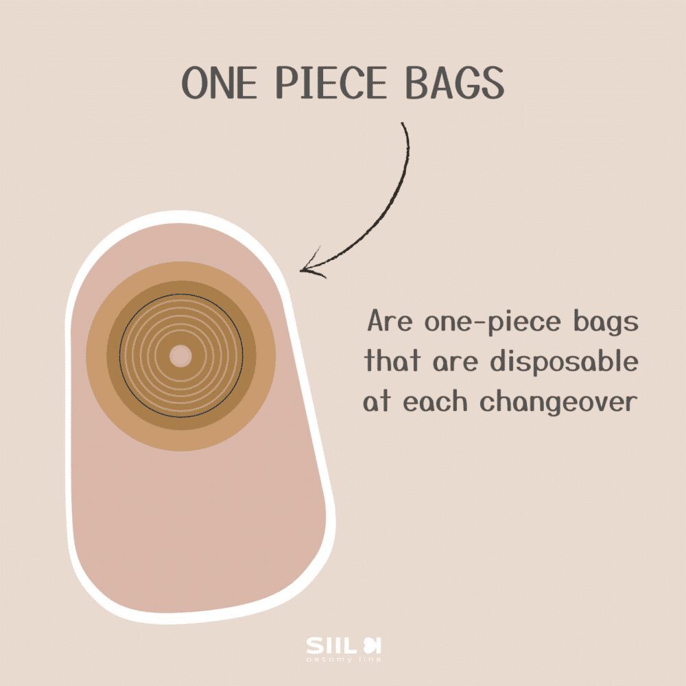 Ileostomy Vs Colostomy: What's The Difference? - 101